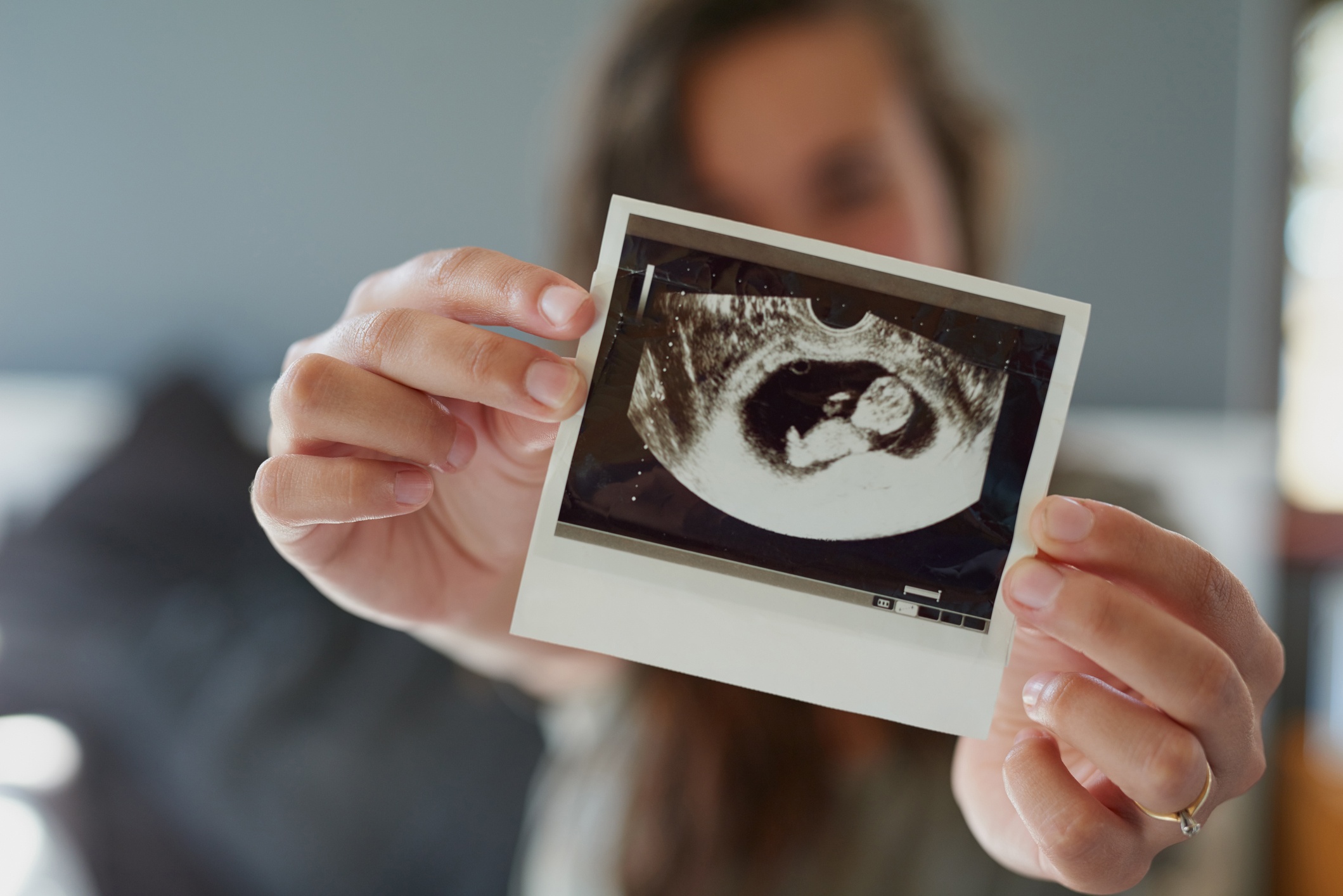 What Should Be the Goal of the Pro-Life Movement?